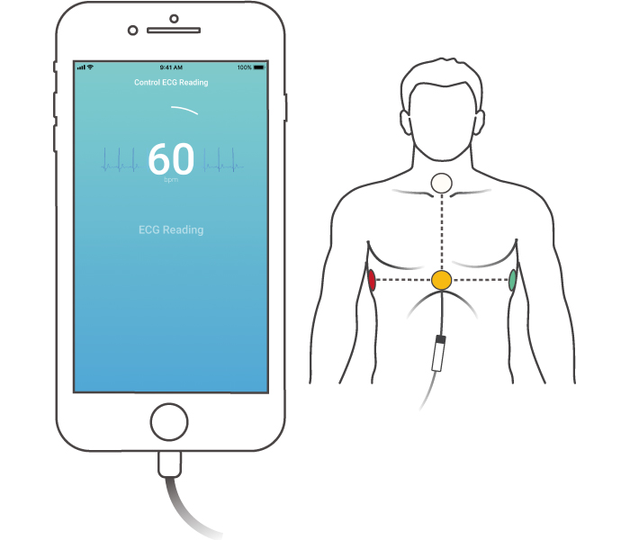 ECG device for smartphones – mobile ECG | CardioSecur