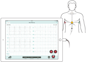 Resting ECG | CardioSecur