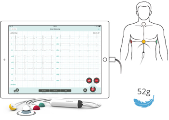 Mobile ECG Monitor | CardioSecur